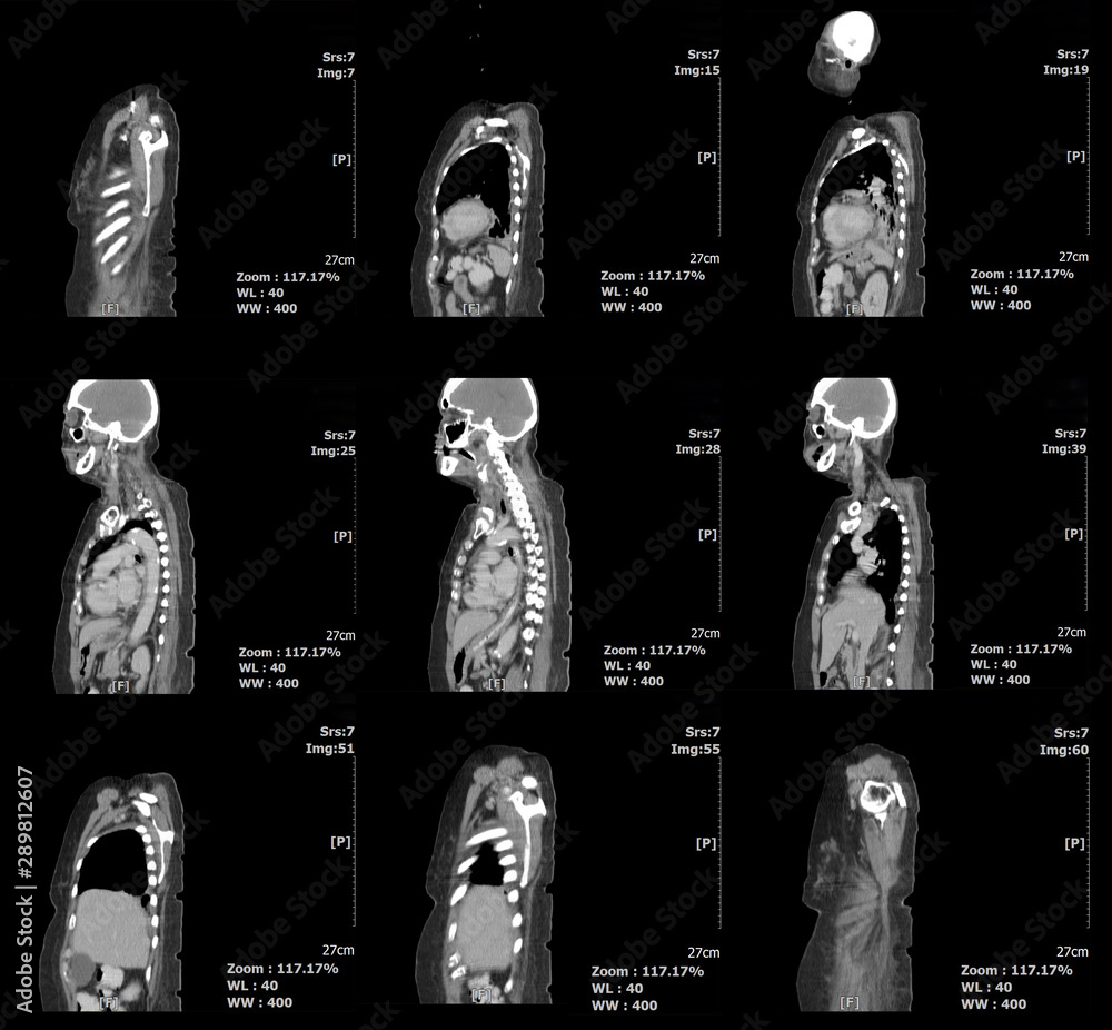 x-ray image mri scan Stock Photo | Adobe Stock