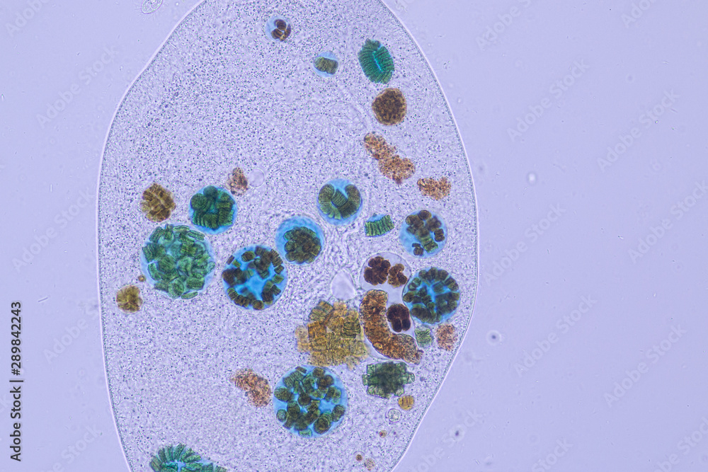 Frontonia sp. is a genus of free-living unicellular ciliate protists under the microscope. Stock ...