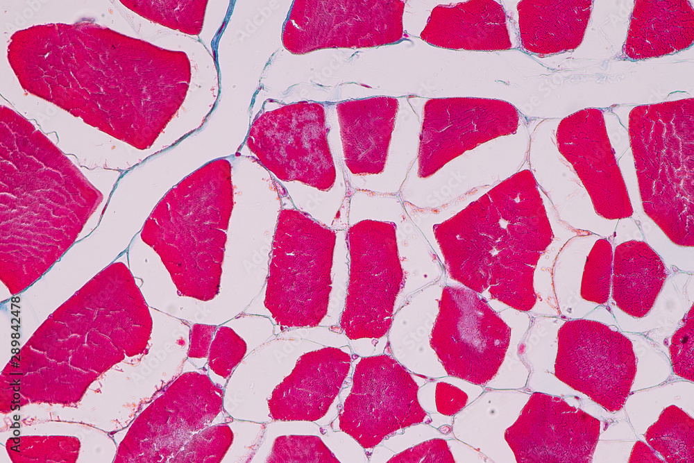 Education anatomy and Histological sample Striated muscle Tissue under ...