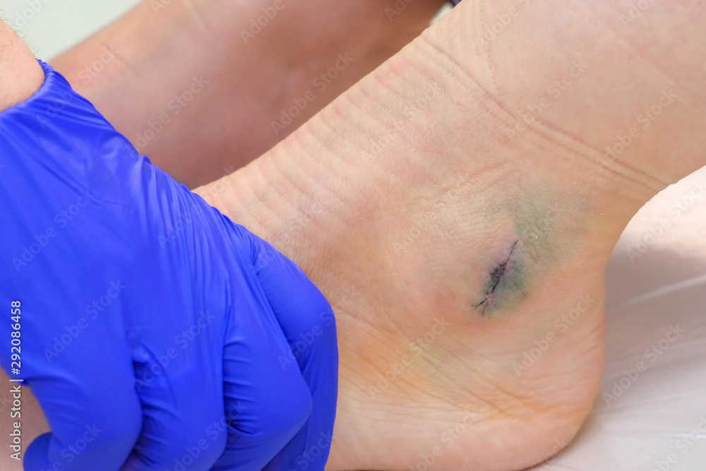 Surgeon bends and unbends patient's leg checking mobility of ankle ...