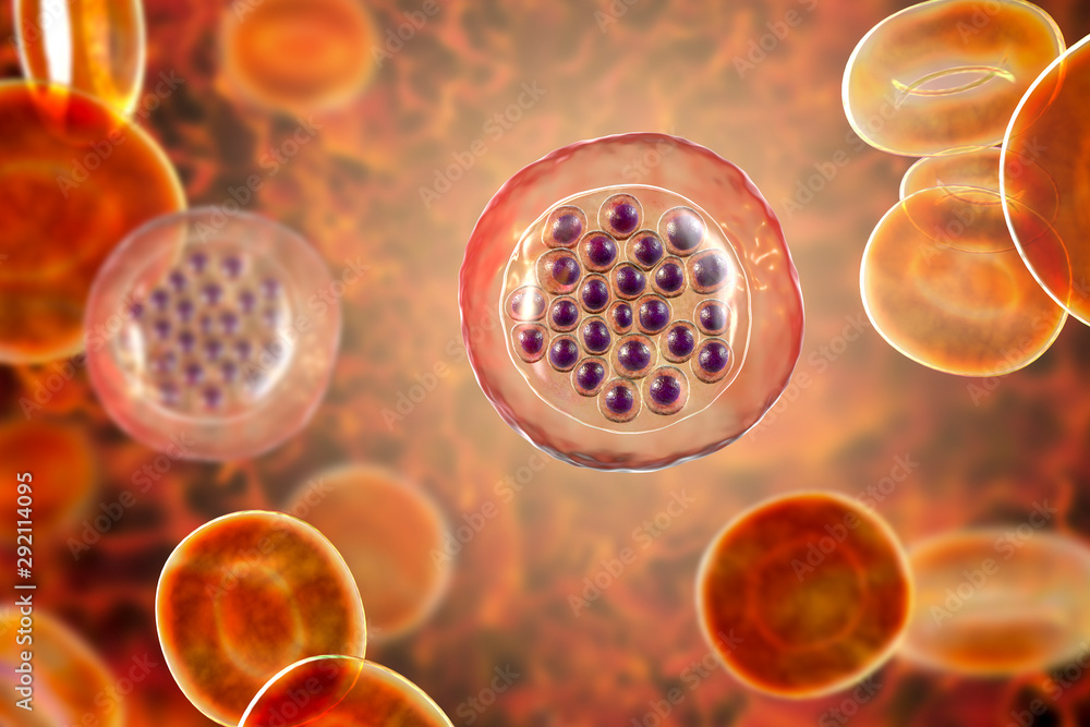 The malaria-infected red blood cells. 3D illustration showing malaria ...