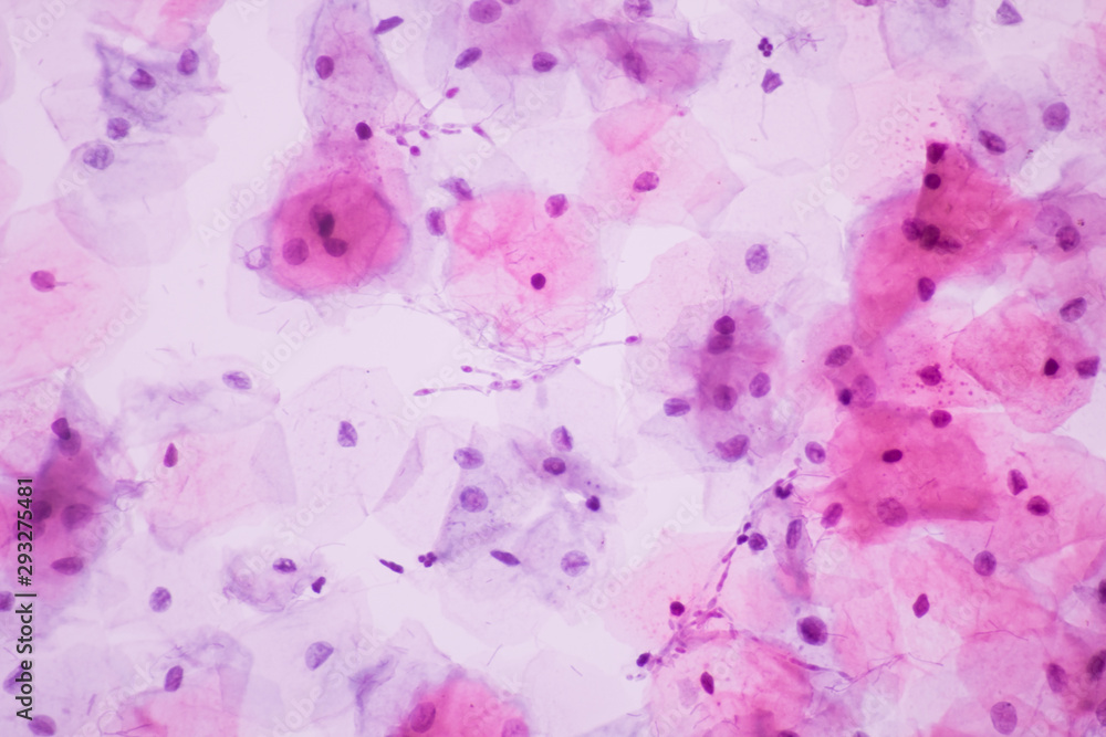 Stock-Foto „View in microscopic of Candidiasis, fungus infection (Yeast ...
