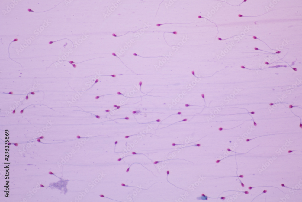 Human sperms viewed in the microscopic 600 x magnification.Spermatozoa ...