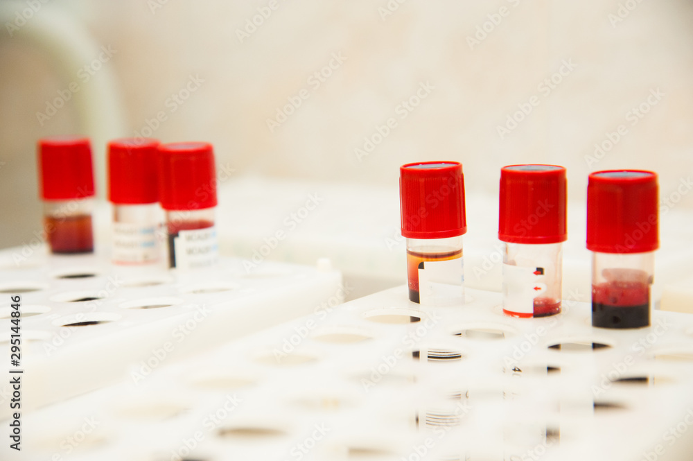 Blood transfusion in the ICU Stock Photo | Adobe Stock