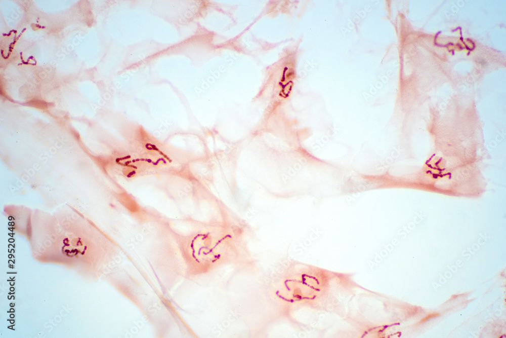 Salivary gland cells of the chromosomes under microscope view for ...