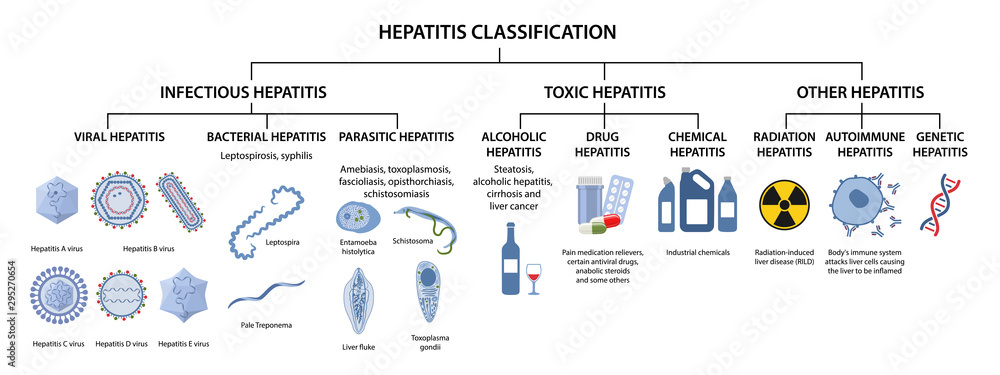 Hepatitis classification. Types of hepatitis: infectious, viral ...