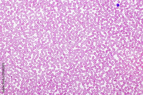 Red blood cells and platelet in blood smear, Wright-Giemsa stain ...