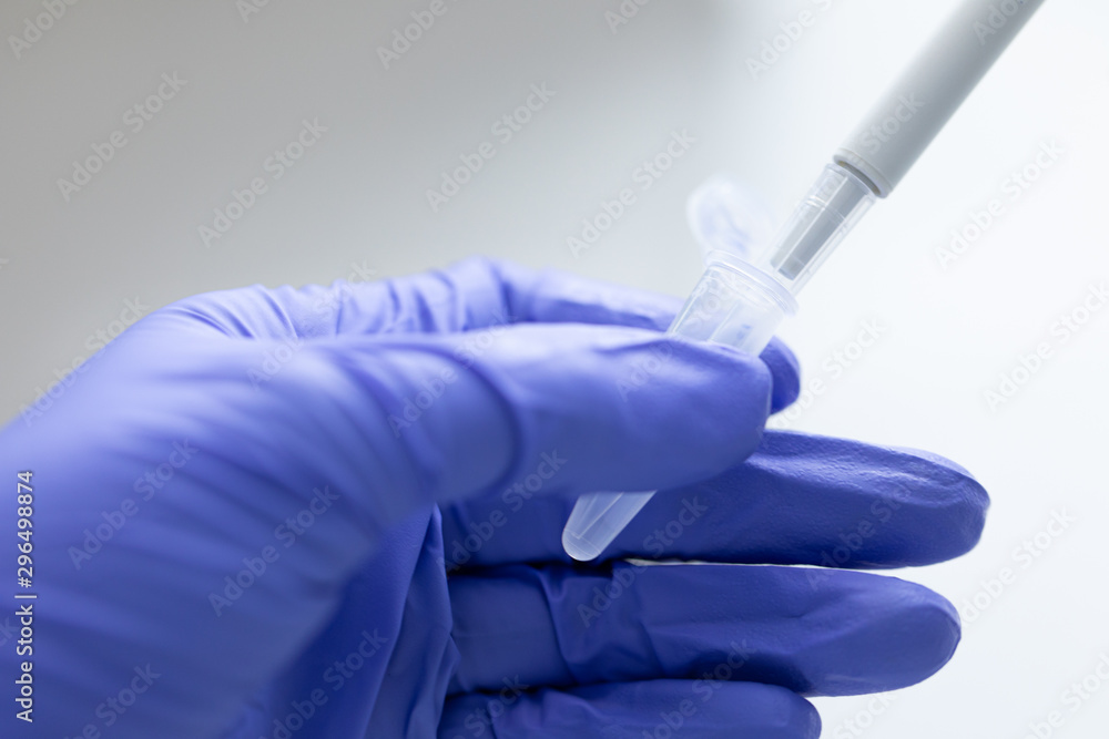 Polymerase Chain Reaction (PCR) and Agarose gel electrophoresis is a ...