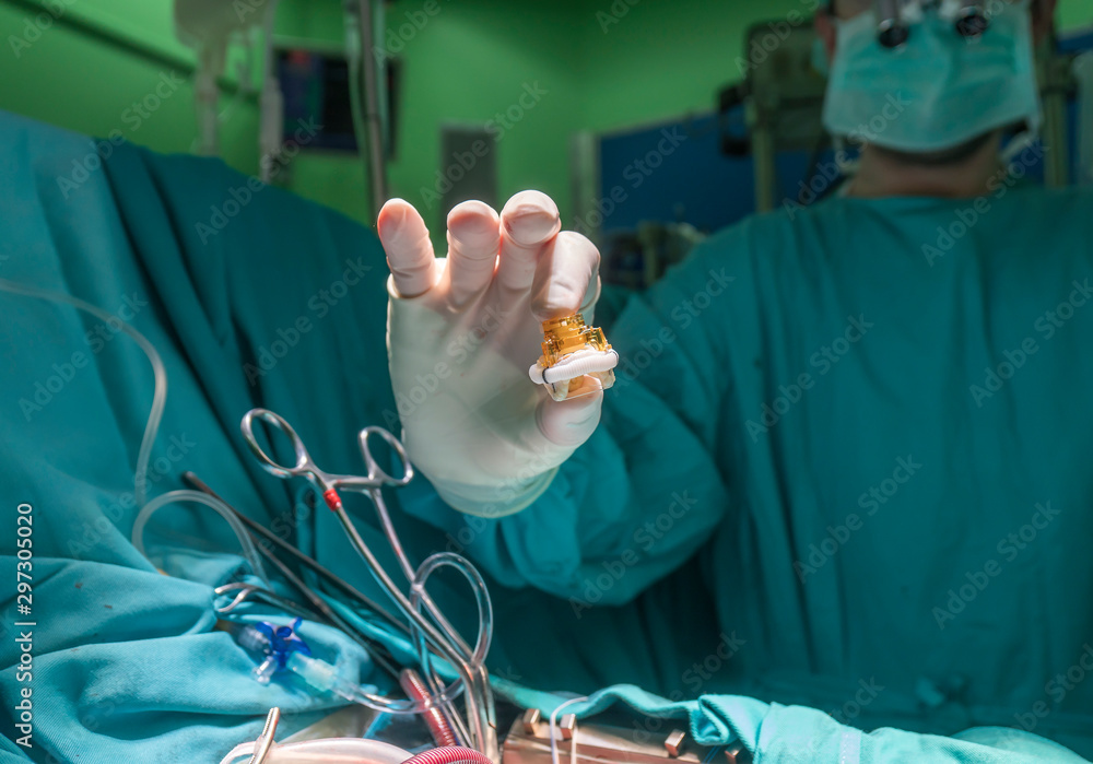 Heart valve prosthesis. Image of surgeon hand holding aortic valve ...