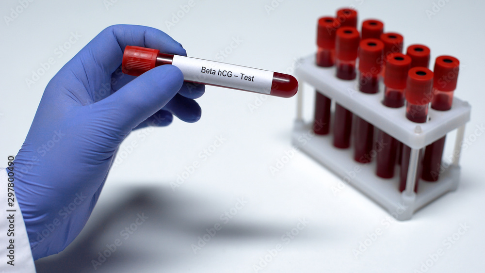 Beta hCG test, doctor showing blood sample in tube, lab research ...