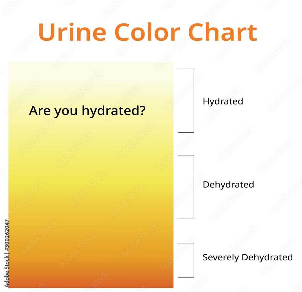 Vector de Stock Urine color chart, Urine in Test tubes, Medical vector ...