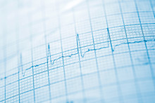 Ecg Free Stock Photo - Public Domain Pictures
