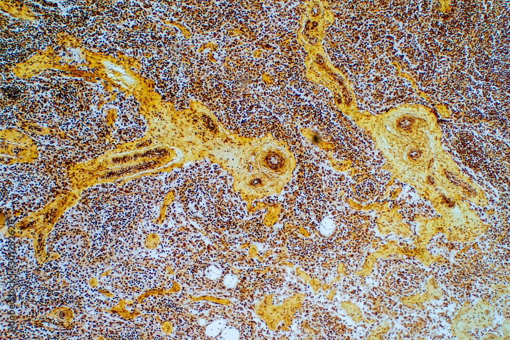 Reticular cell is a type of fibroblast. They are found in many tissues ...