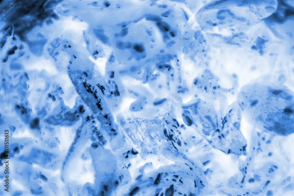 cancer cells under the microscope. Tissues affected by cancer cells ...