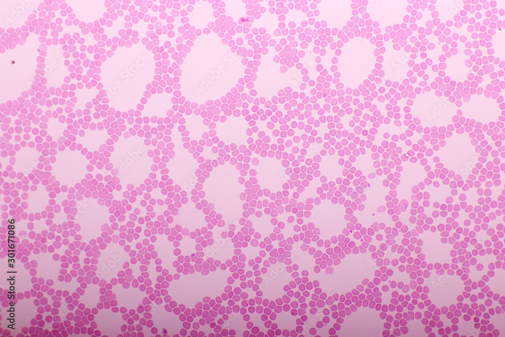 Red blood cells in blood smear, Wright-Giemsa stain, analyze by ...