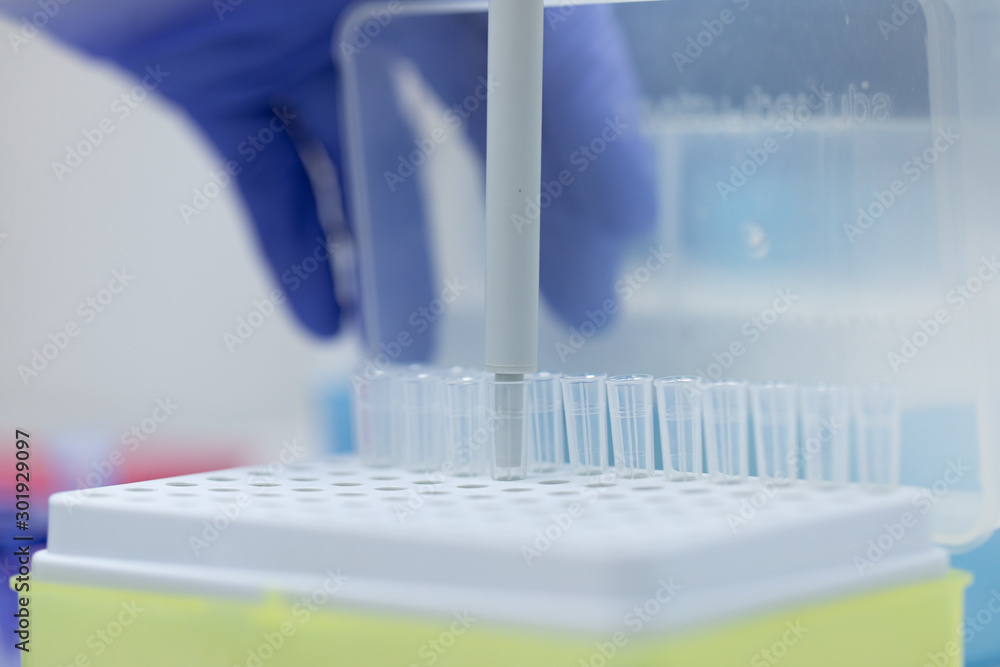 Foto de Stock Polymerase Chain Reaction (PCR) and Agarose gel ...