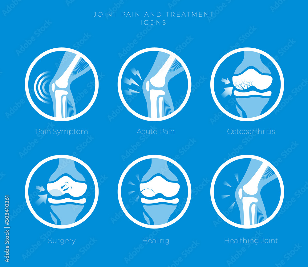 Set of icons of the joints and their treatment Cartilage damage ...