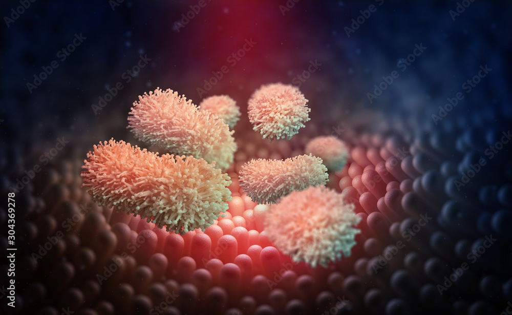 Parasites in intestines. Indigestion, germs, infection and viruses in ...