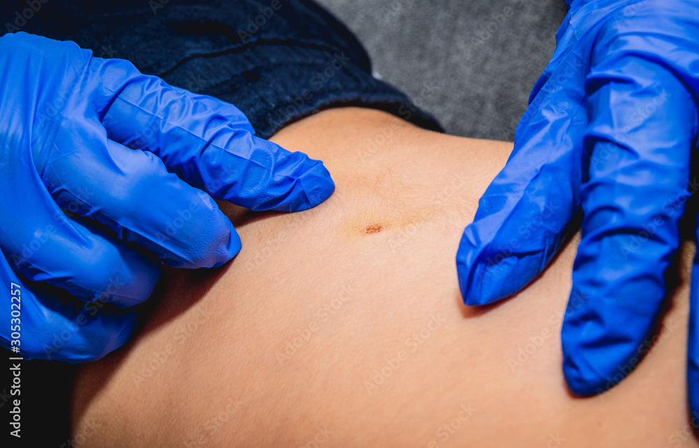 Checking for marks on the child's body. The doctor checks injuries ...