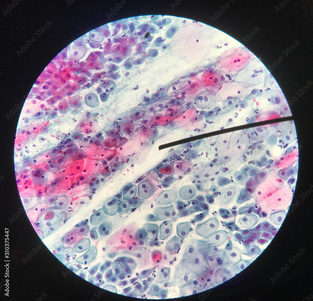 Cells in reproductive female cytology and histology concept. Stock ...