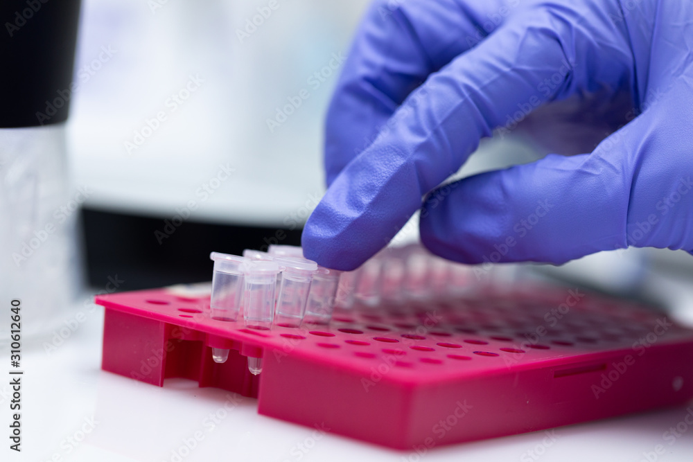 Polymerase Chain Reaction (PCR) and Agarose gel electrophoresis is a ...