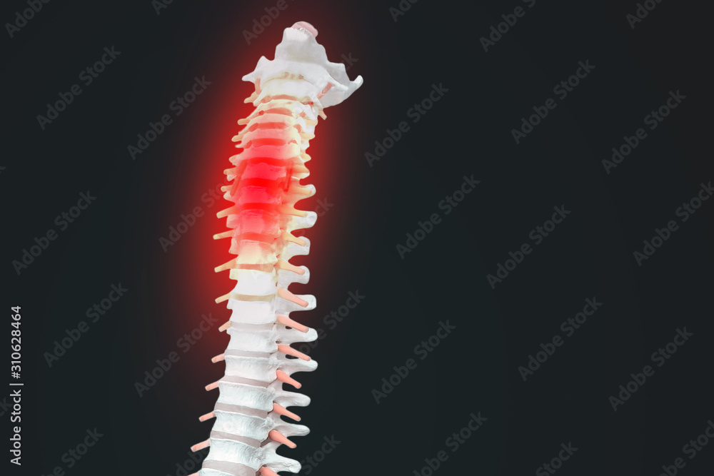 Realistic skeletal human spine and vertebral column or intervertebral ...