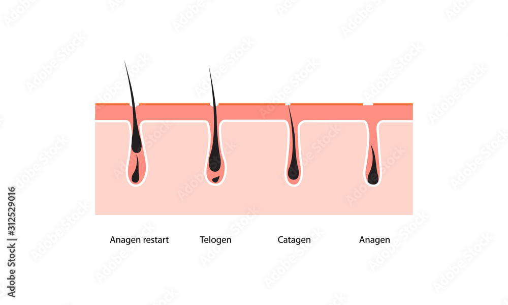 Hair growth cycle skin. vector illustration Stock Vector | Adobe Stock
