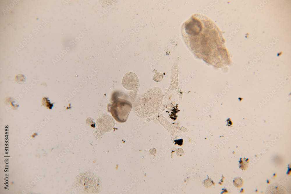 Study Movement and Specimens of Transversotrema patiallensis (parasite ...