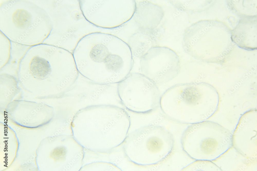 Mitosis Horse Ascaris egg under the microscope Stock Photo | Adobe Stock