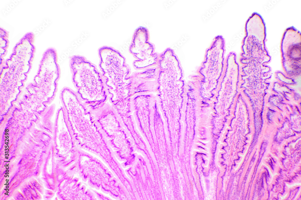 Сross-section of the small intestine under the microscope (Small ...