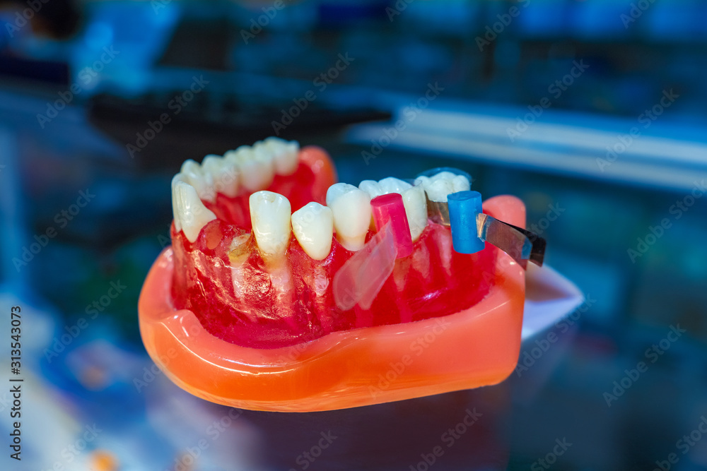 Dental clinic. Anatomically accurate model of the tooth cavity. Dental ...