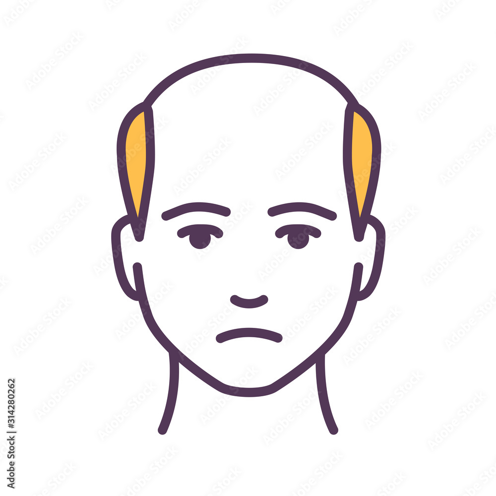 Man with a bald head color line icon. Baldness stage. Alopecia ...