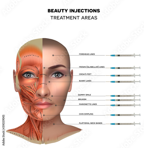 Beauty aesthetic injections treatment area Stock Vector | Adobe Stock