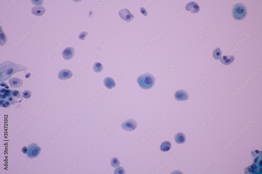 Foto de Stock View in microscopic of normal human cervix cells.Squamous ...