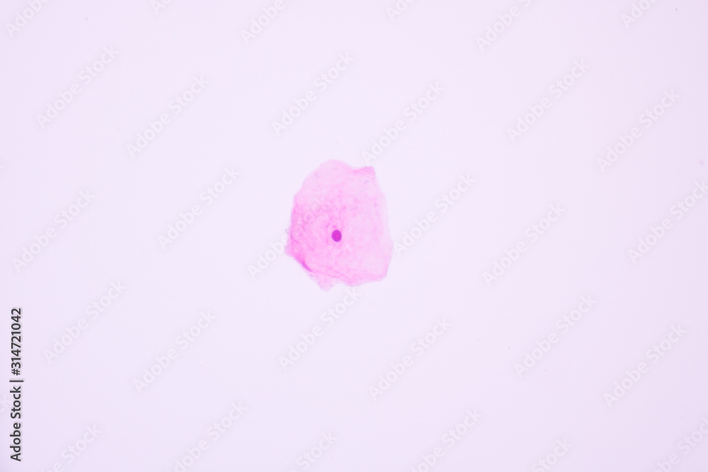 View in microscopic of normal human cervix cells.Squamous epithelium ...