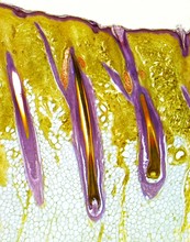 Hair Follicle Free Stock Photo - Public Domain Pictures