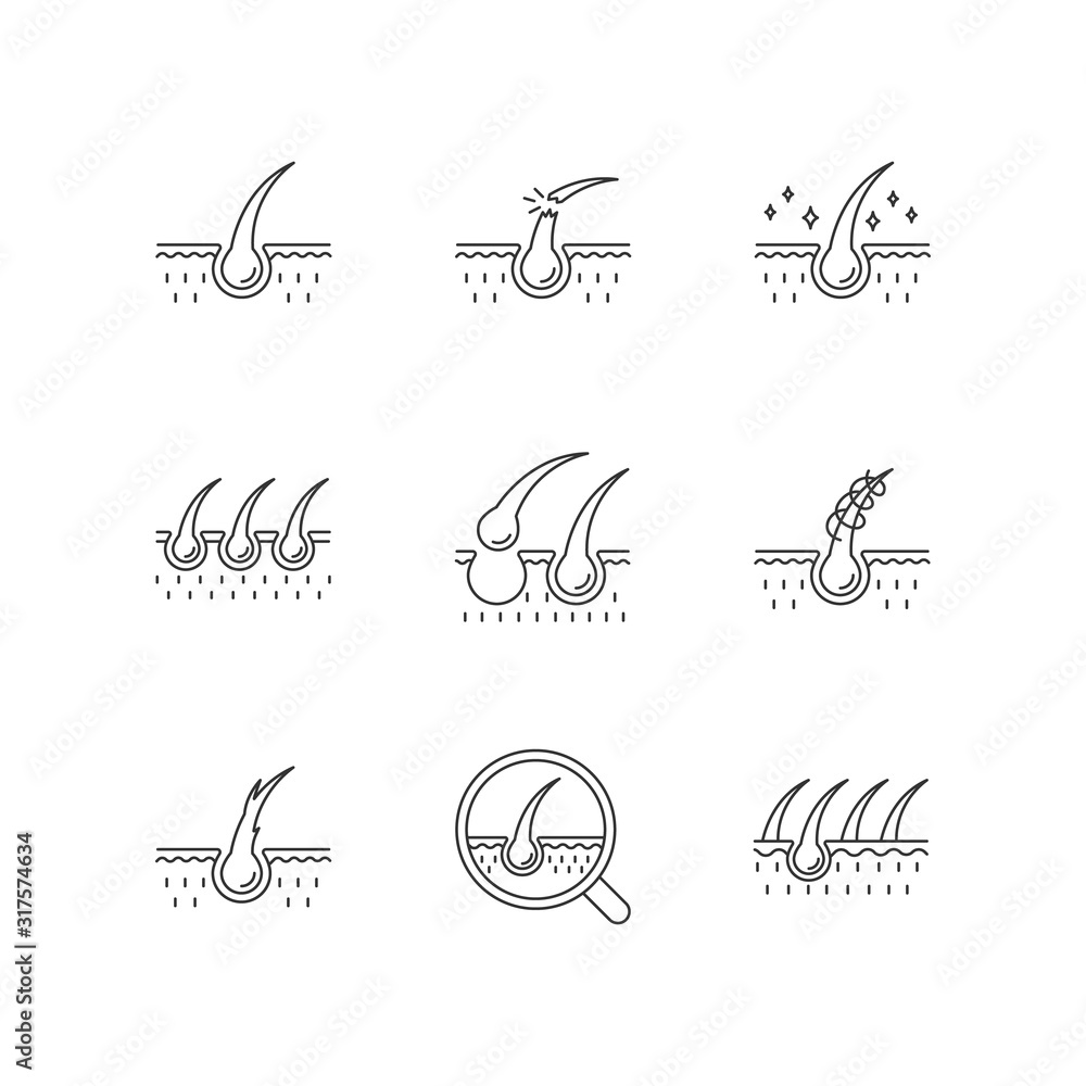 Hair loss pixel perfect linear icons set. Damaged hair, unhealthy roots ...