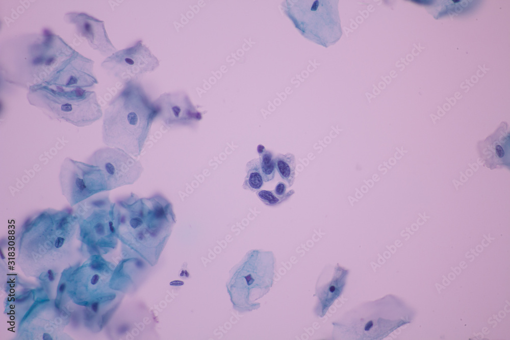 View in microscopic of normal human cervix cells.Squamous epithelium ...