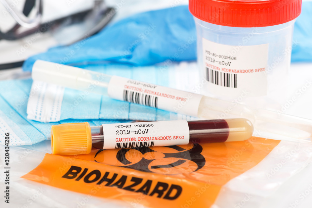 Foto de Stock Corona Covid-19 Virus Blood, Sputum And Specimen Tests ...