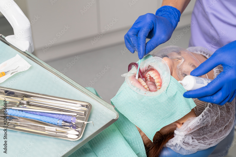 The dentist uses a cotton swab to apply the medicine to the patient’s ...