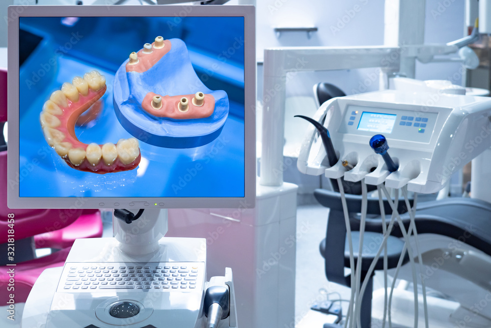 Modern dental equipment. Computer technology helps to model the ...