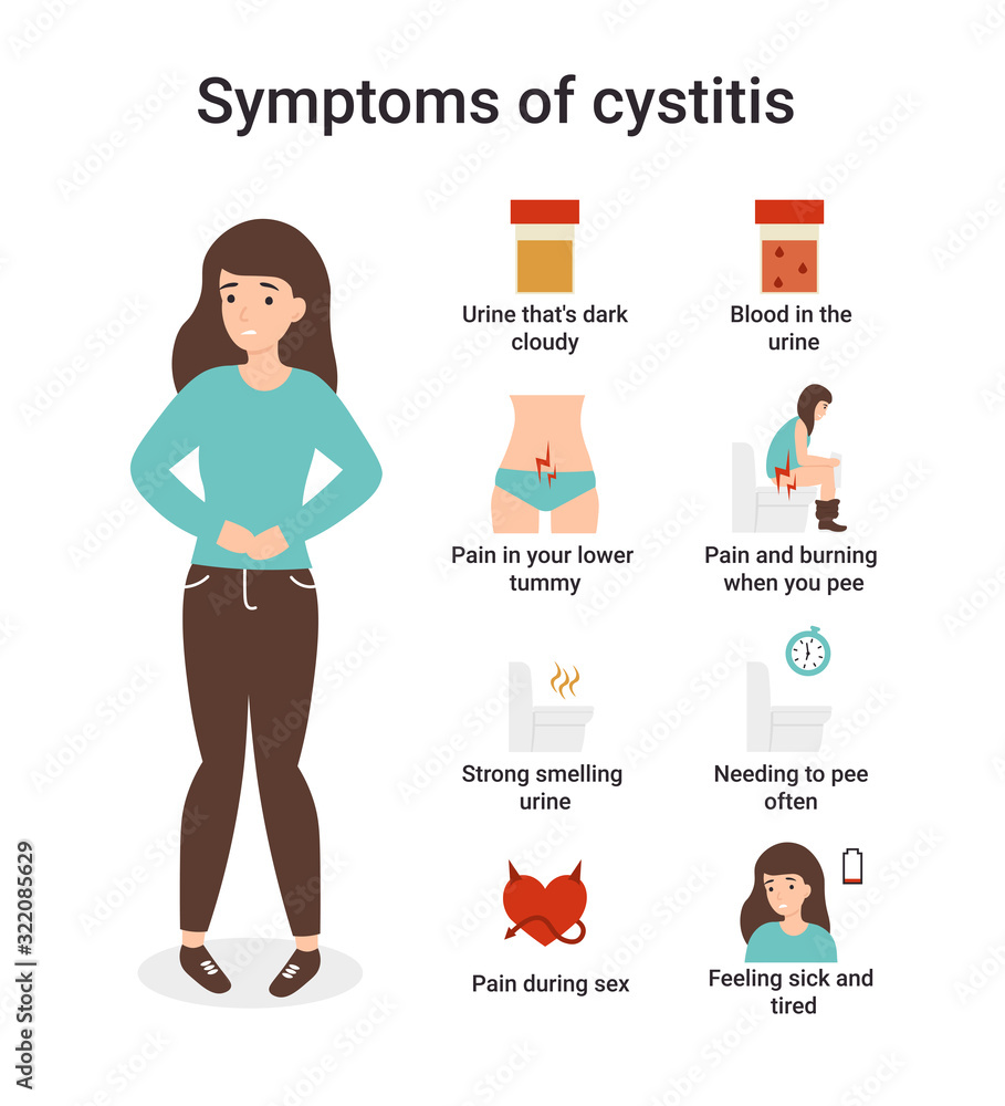 Urinary Tract Infections or cystitis. Set symptoms of cystitis. Flat ...