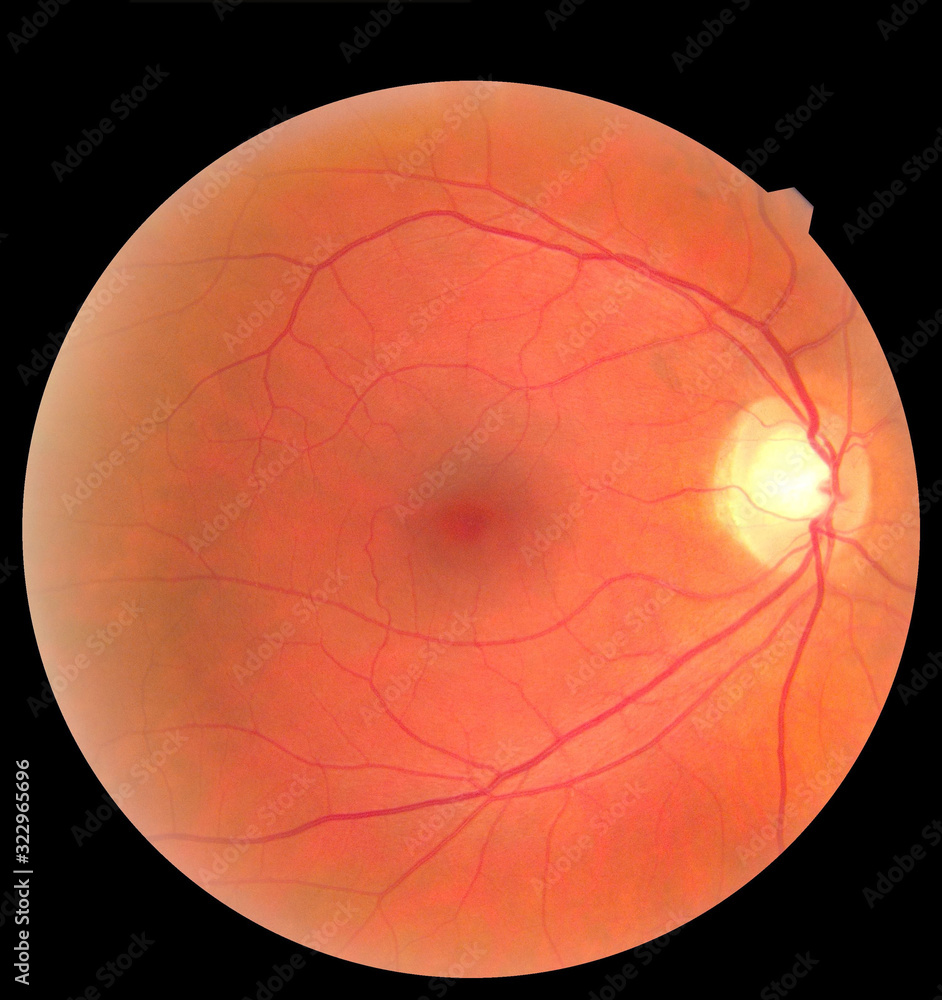 Human eye anatomy taking images with Mydriatic Retinal cameras ...
