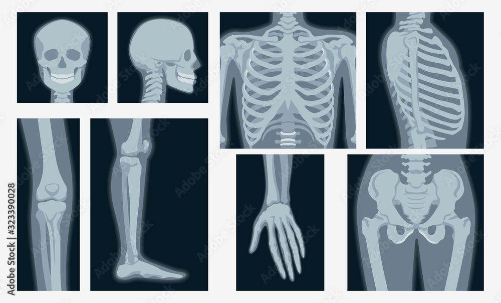 Different x-rays shot of human body part set vector flat illustration ...