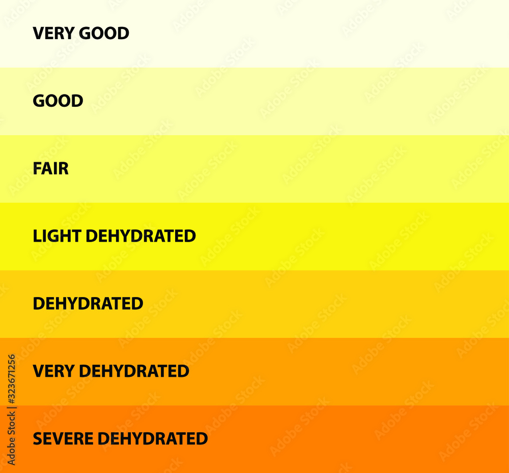 Urine color, Dehydration Urine Color Chart, vector illustration Stock ...