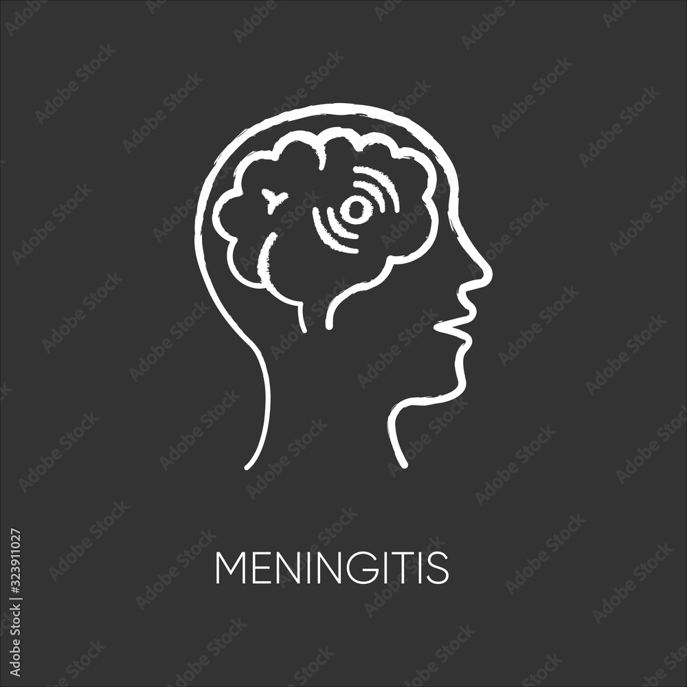 Image vectorielle Stock Meningitis chalk white icon on black background ...