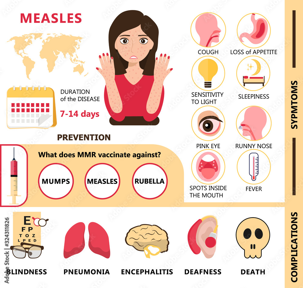 Measles infographic concept vector. Infected human with papules on the ...