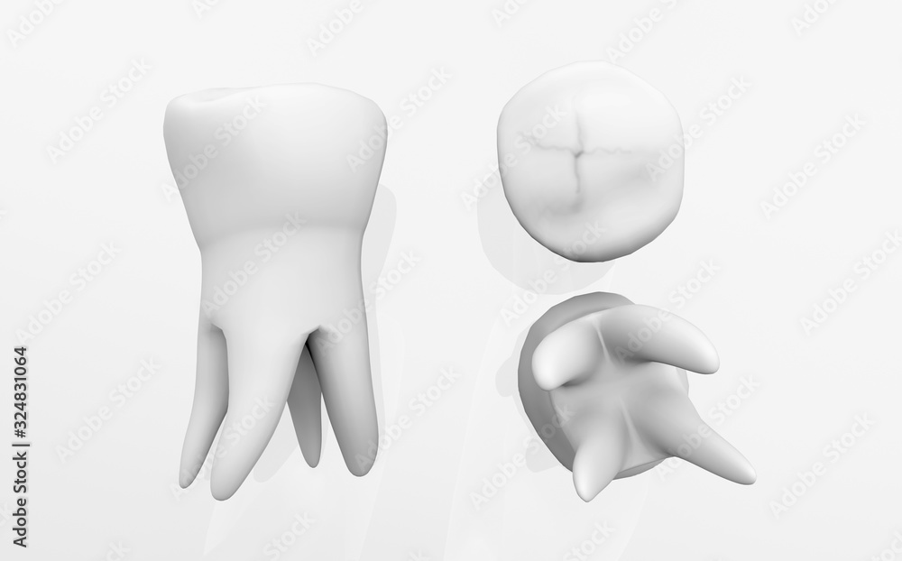 Tooth lateral. Front view, top view, bottom view. Dental implantation ...