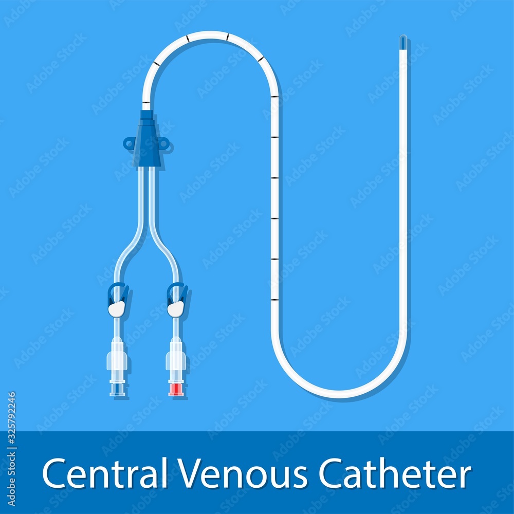 central venous catheter CVC PICC line peripherally inserted access ...