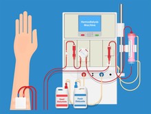 Apheresis Blood Machine Free Stock Photo - Public Domain Pictures